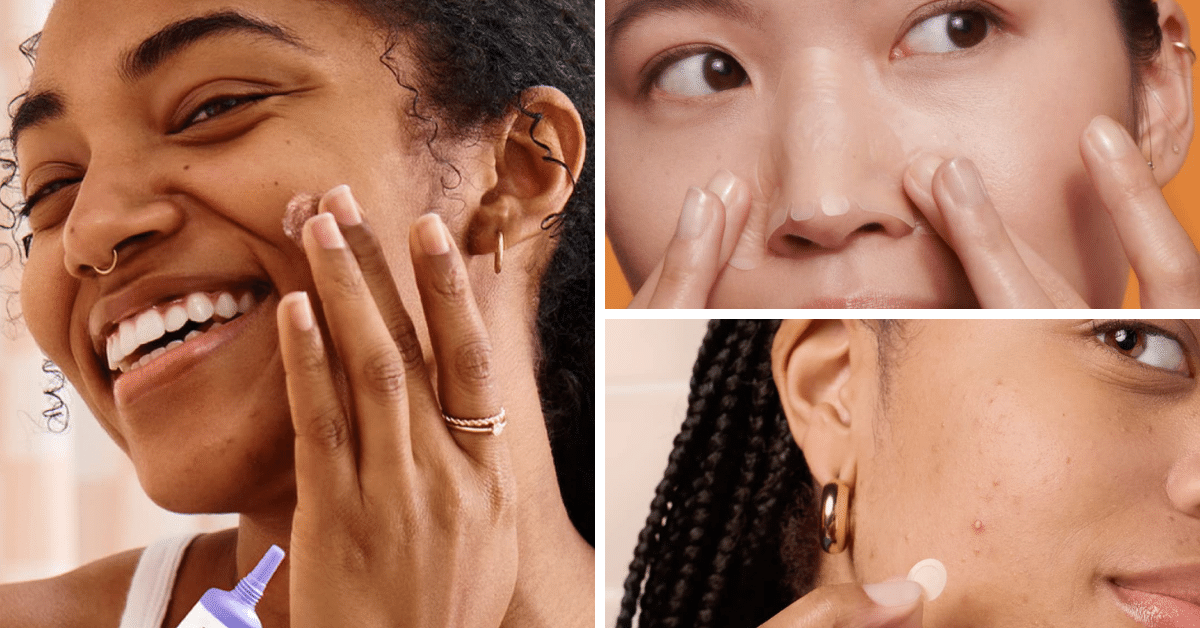 Say Goodbye To Acne With These 5 Hero Cosmetics Products!